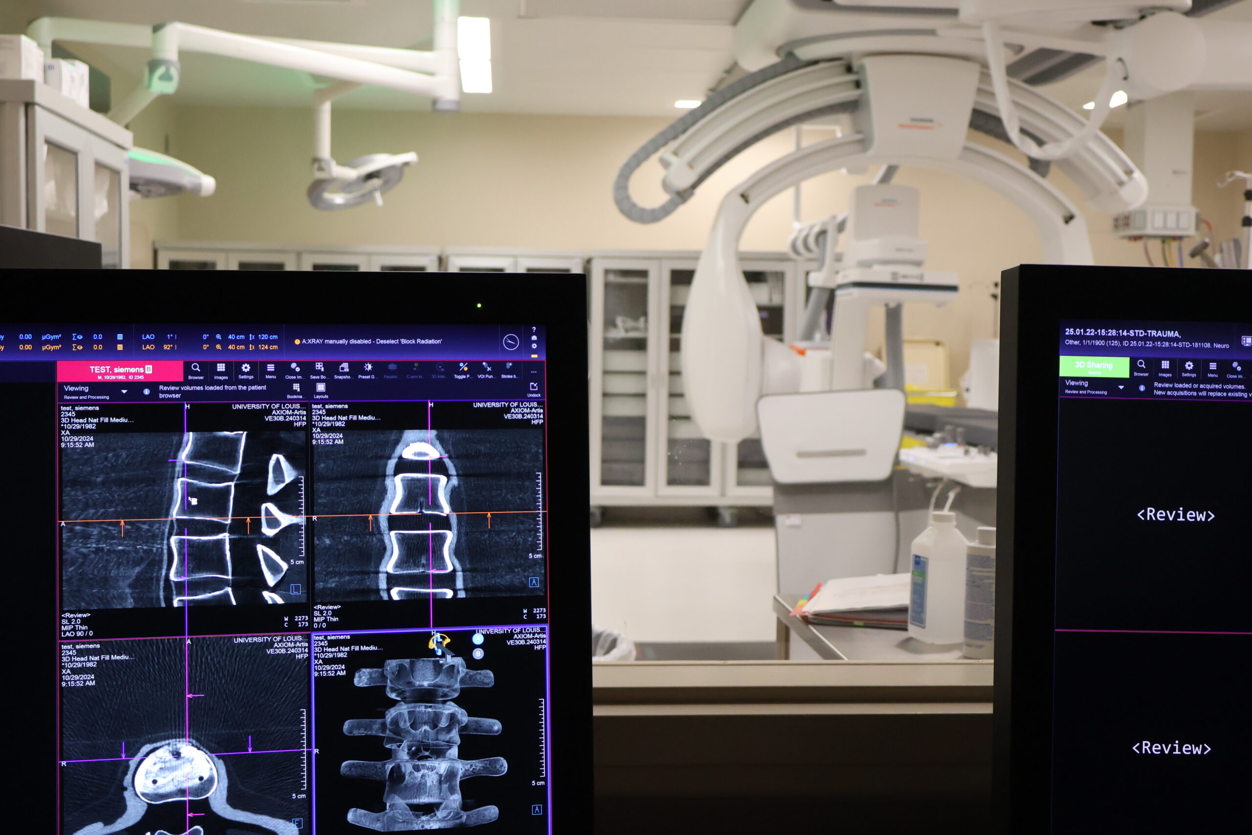 Hybrid operating room a first at UofL Health – Jewish Hospital - Lane ...