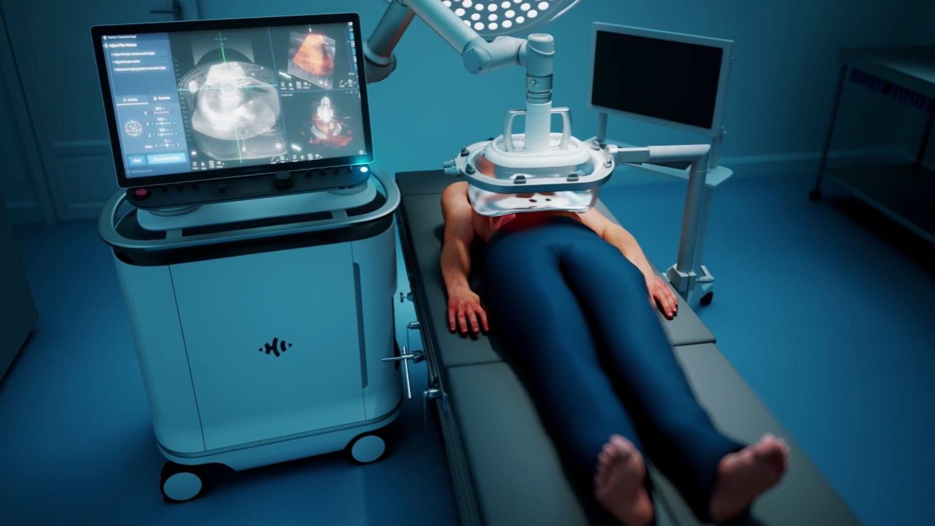 UofL Health treats first liver tumor patient with non-invasive robotic ...